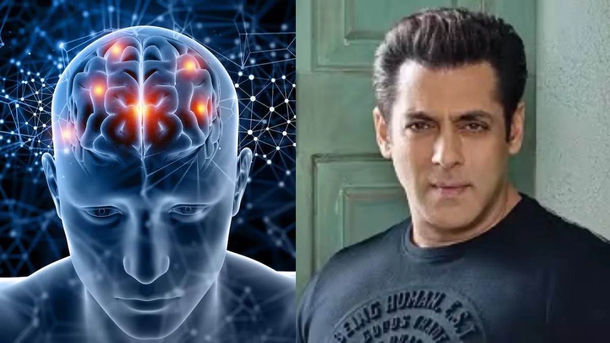 Brain Aneurysm Salman Khan Brain Aneurysm Salman Khan