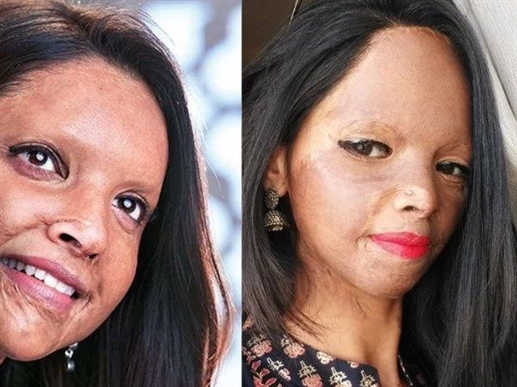 Chhapaak First Look : 'ਐਸਿਡ ਅਟੈਕ ਸਰਵਾਈਵਰ' ਬਣੀ ਦੀਪਿਕਾ ਪਾਦੂਕੋਨ, ਪਛਾਣਨਾ ...